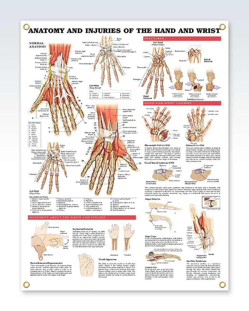 Laminated Injuries of the Hand and Wrist Poster | ClinicalPosters
