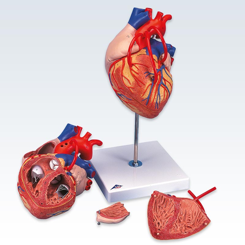 3B Heart Bypass 2x Size 4-Part Anatomical Model | ClinicalPosters