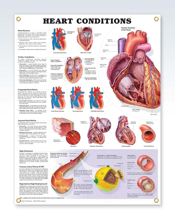 Laminated Heart Conditions Exam-Room | ClinicalPosters