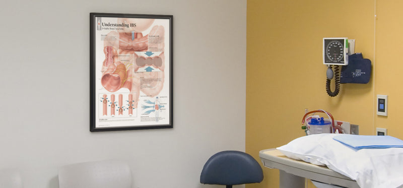 Understanding IBS Exam-Room Anatomy Posters | ClinicalPosters