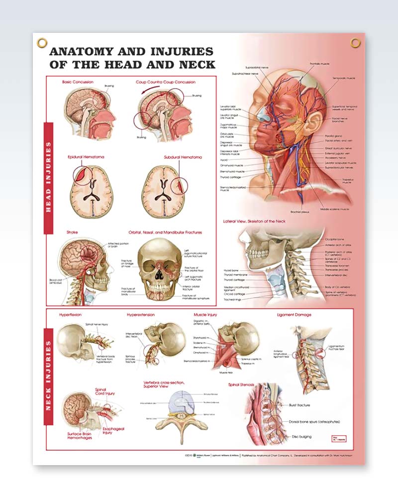 Head and Neck Injuries Anatomy Poster | ClinicalPosters