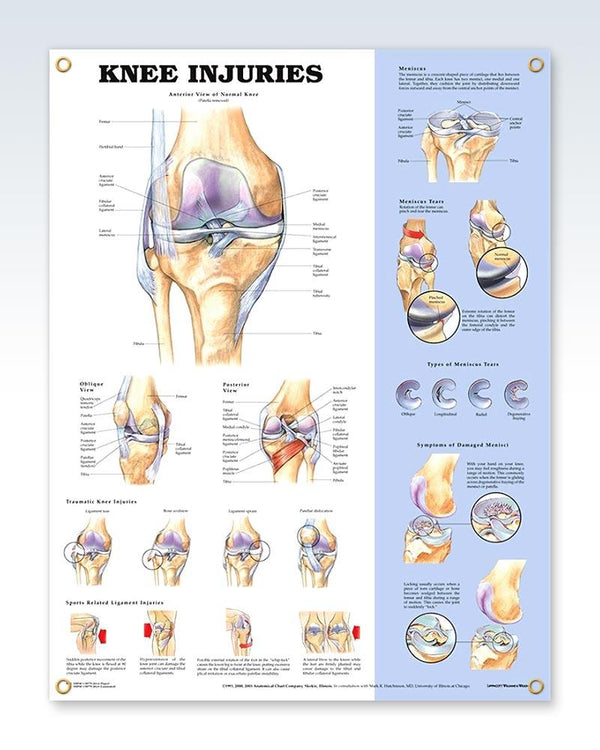 Laminated Knee Injuries Human Anatomy Poster | ClinicalPosters