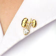 Nephrologists Kidney Anatomy Lapel Pin | ClinicalPosters