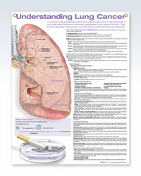 Understanding Lung Cancer Laminated Anatomy Poster | ClinicalPosters