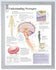 Meningitis Exam-Room Anatomy Poster | ClinicalPosters