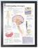 Meningitis Exam-Room Anatomy Poster | ClinicalPosters