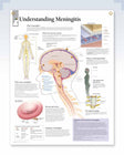 Meningitis Exam-Room Anatomy Poster | ClinicalPosters