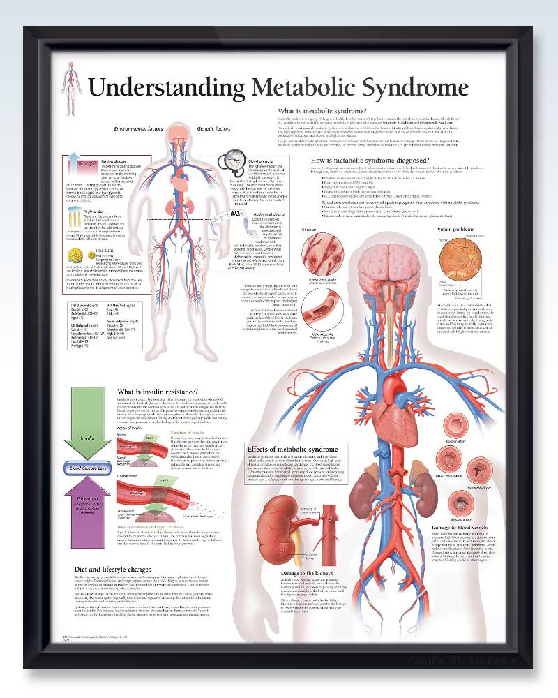Metabolic Syndrome Exam-Room Anatomy Poster | ClinicalPosters