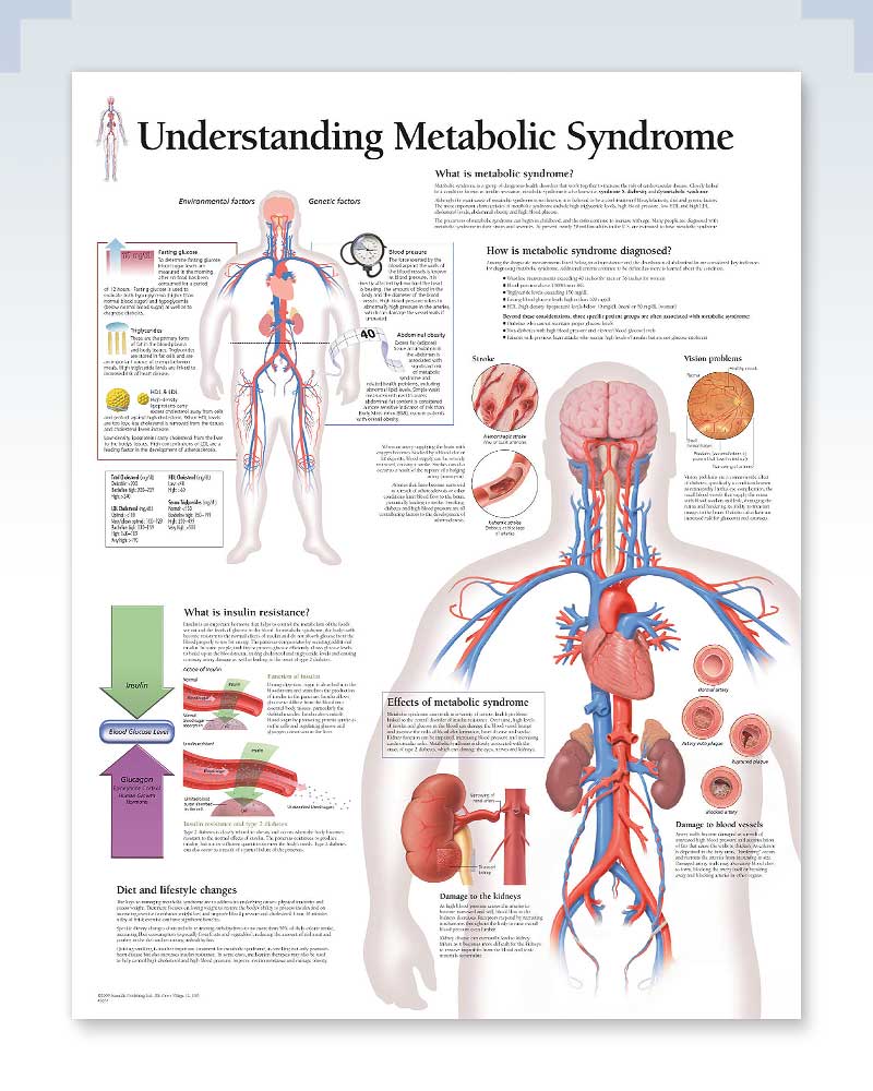 Metabolic Syndrome Exam-Room Anatomy Poster | ClinicalPosters