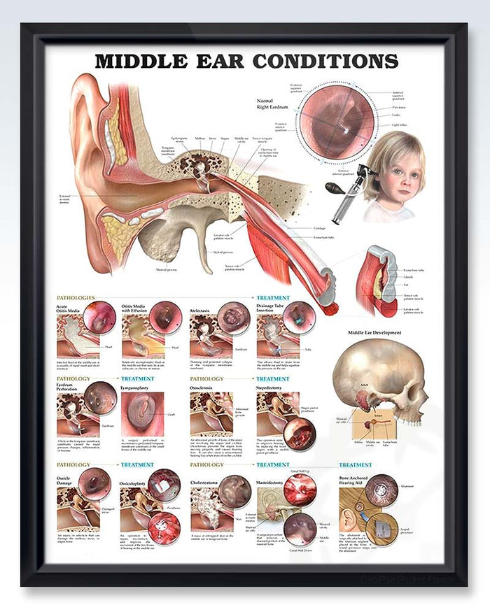 ENT Human Anatomy Posters – ClinicalPosters