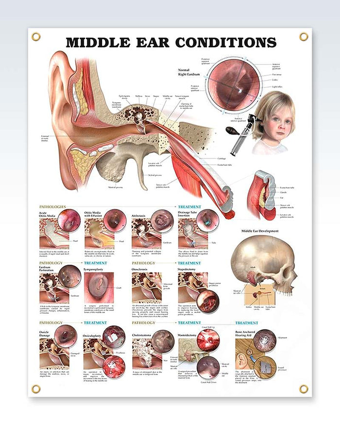 Laminated Middle Ear Conditions Anatomy Posters | ClinicalPosters