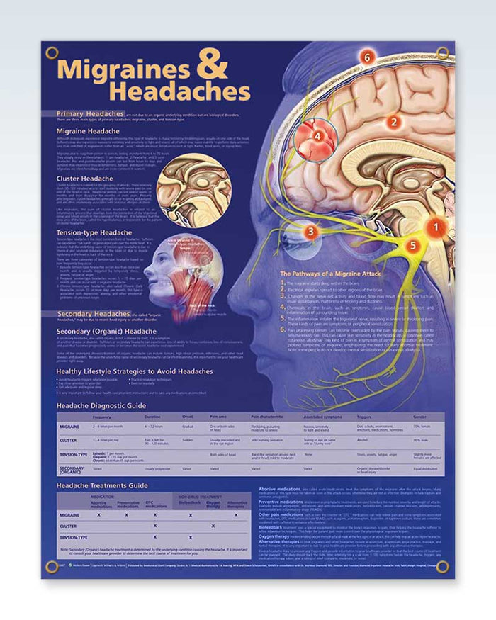 Laminated Migraines & Headaches Anatomy Posters | ClinicalPosters