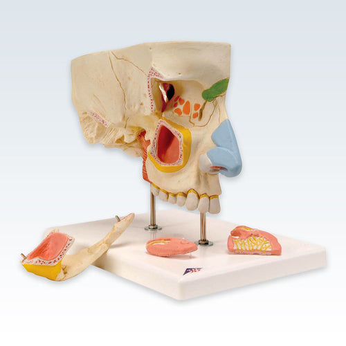 Human Nose With Sinuses 5-Part Anatomical Model | ClinicalPosters