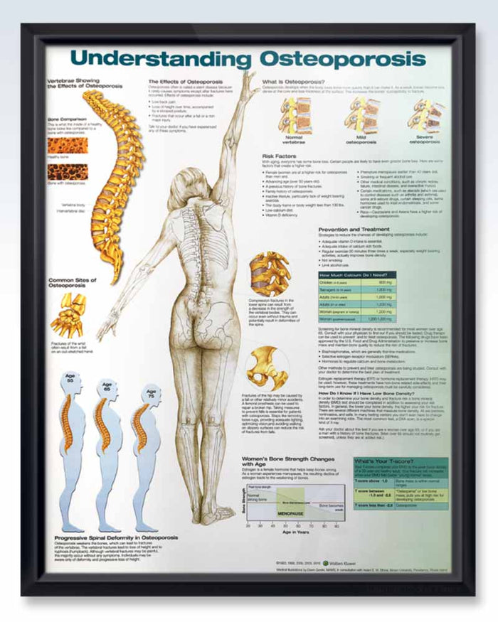 Orthopaedics Medical Anatomy Posters | Page 2 | ClinicalPosters
