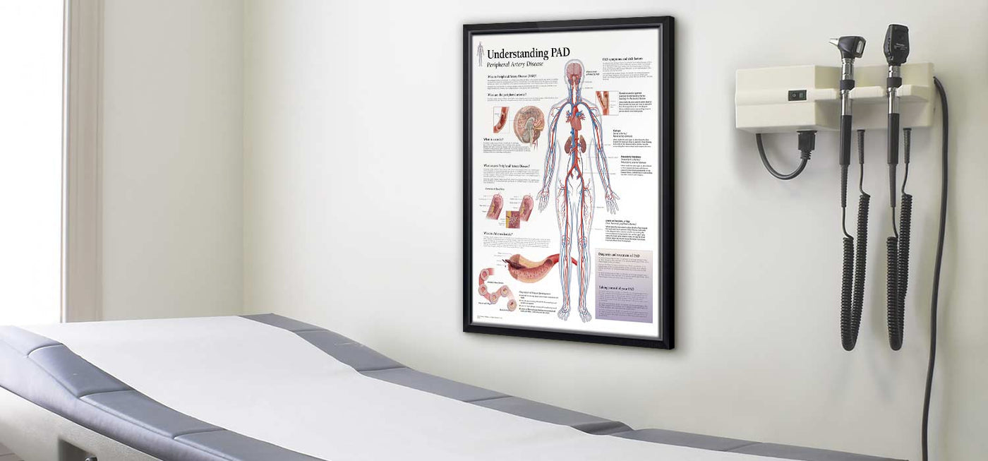 Understanding PAD Exam-Room Anatomy Poster | ClinicalPosters