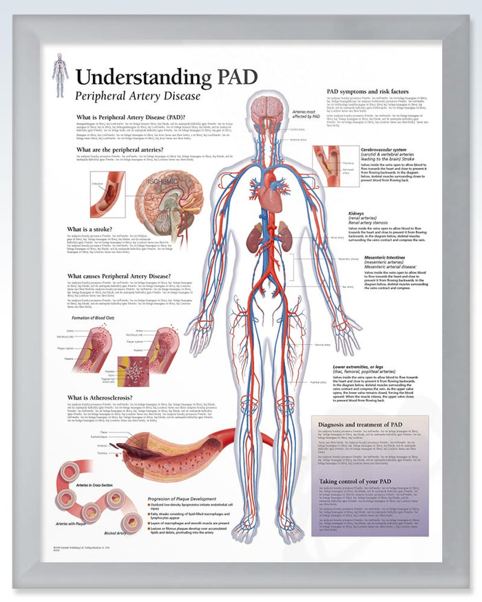 Understanding PAD Exam-Room Anatomy Poster | ClinicalPosters