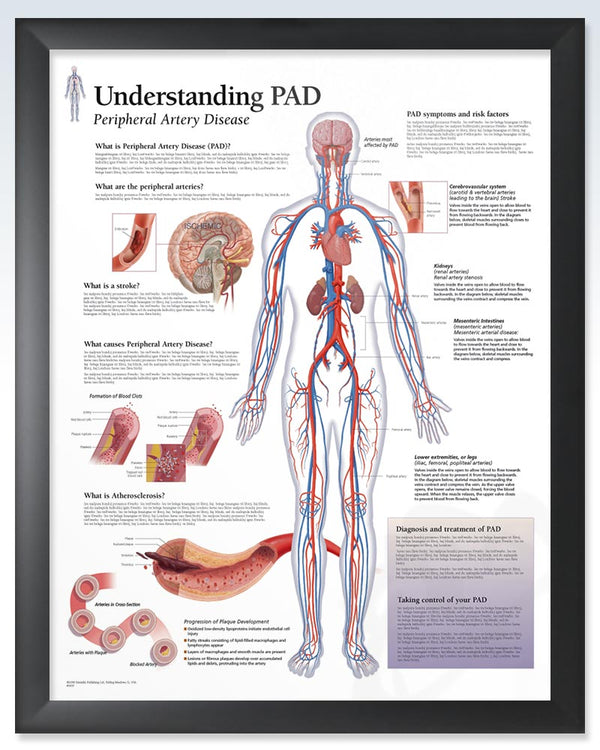 Understanding PAD Exam-Room Anatomy Poster | ClinicalPosters