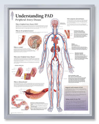 Understanding PAD Exam-Room Anatomy Poster | ClinicalPosters