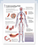 Understanding PAD Exam-Room Anatomy Poster | ClinicalPosters