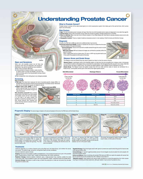 Cancer Medical Anatomy Posters | ClinicalPosters