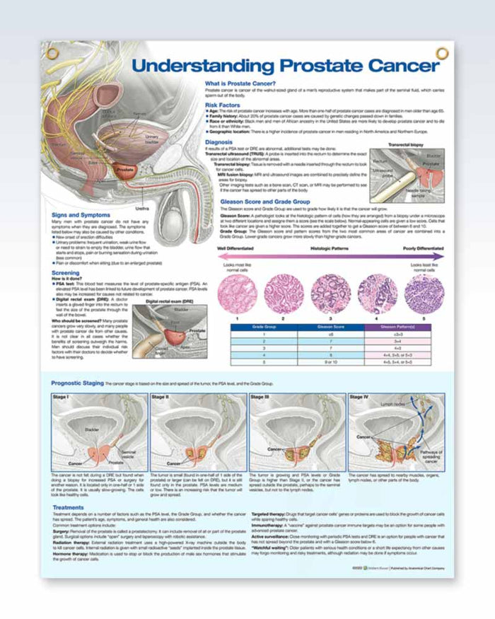 Cancer Medical Anatomy Posters | ClinicalPosters