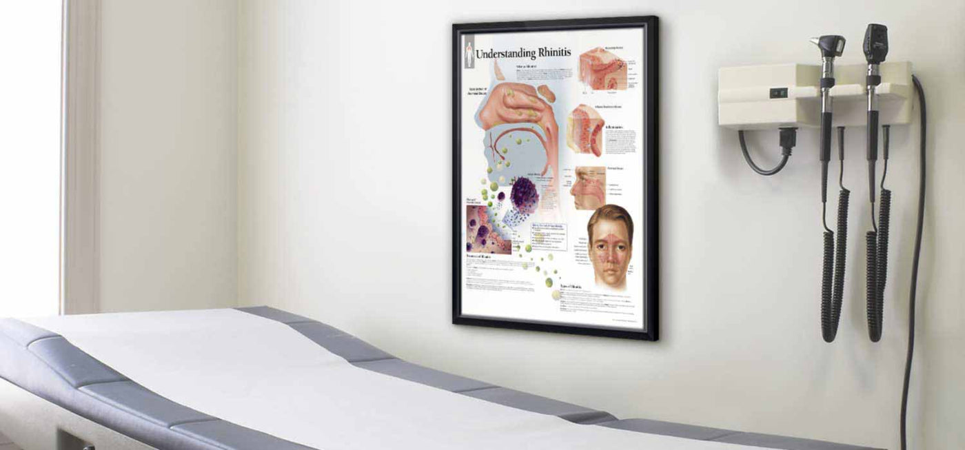 Understanding Rhinitis Exam-Room Anatomy Poster | ClinicalPosters