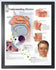 Understanding Rhinitis Exam-Room Anatomy Poster | ClinicalPosters