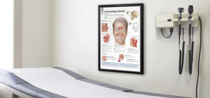 Understanding Sinusitis Exam-Room Human Anatomy Poster