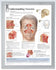 Understanding Sinusitis Exam-Room Human Anatomy Poster
