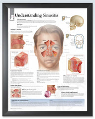 Understanding Sinusitis Exam-Room Human Anatomy Poster