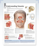 Understanding Sinusitis Exam-Room Human Anatomy Poster