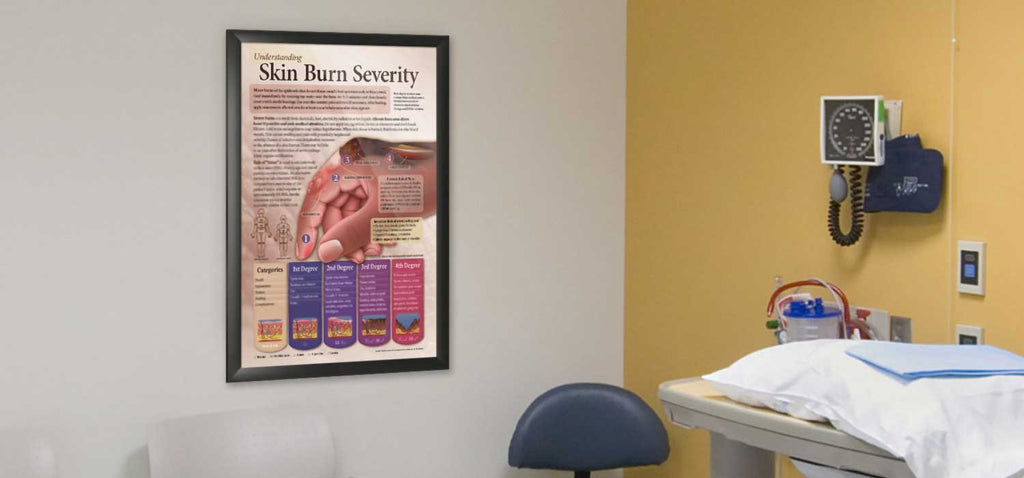 Skin Burn Severity Large Anatomy Posters | ClinicalPosters