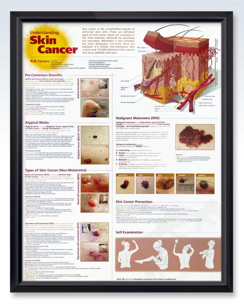 Dermatologists Medical Anatomy Posters – ClinicalPosters