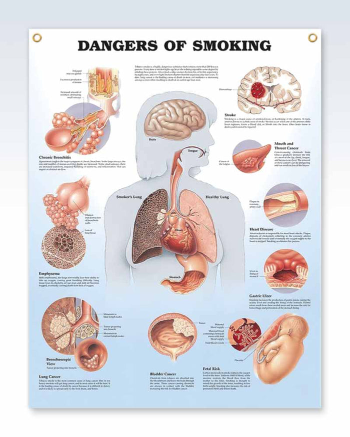 Laminated Dangers of Smoking Anatomy Posters | ClinicalPosters