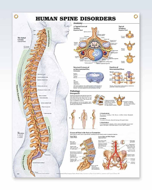Laminated Human Spine Disorders Anatomy Posters | ClinicalPosters