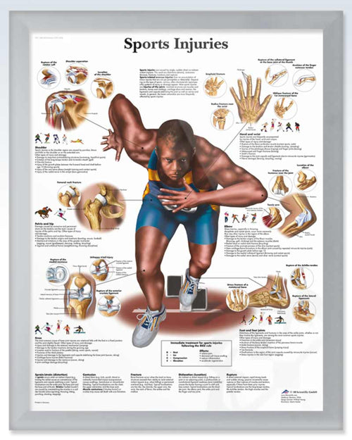 Sports Injuries Exam Room Poster | ClinicalPosters