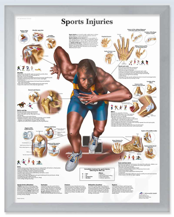 Sports Injuries Exam Room Poster | ClinicalPosters