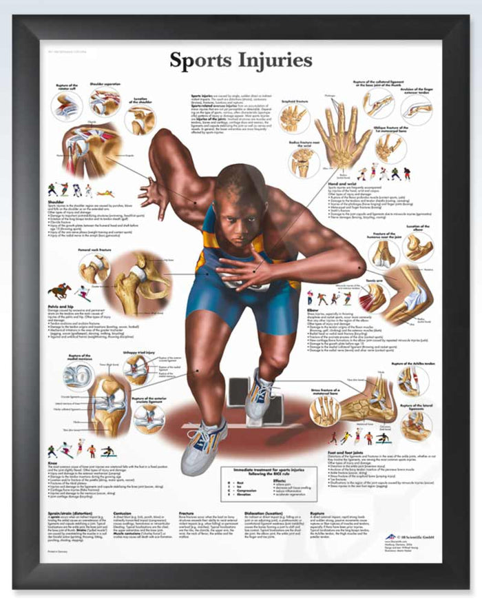 Sports Injuries Exam Room Poster | ClinicalPosters