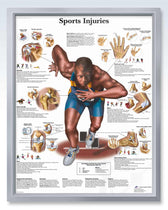 Sports Injuries Exam Room Poster | ClinicalPosters