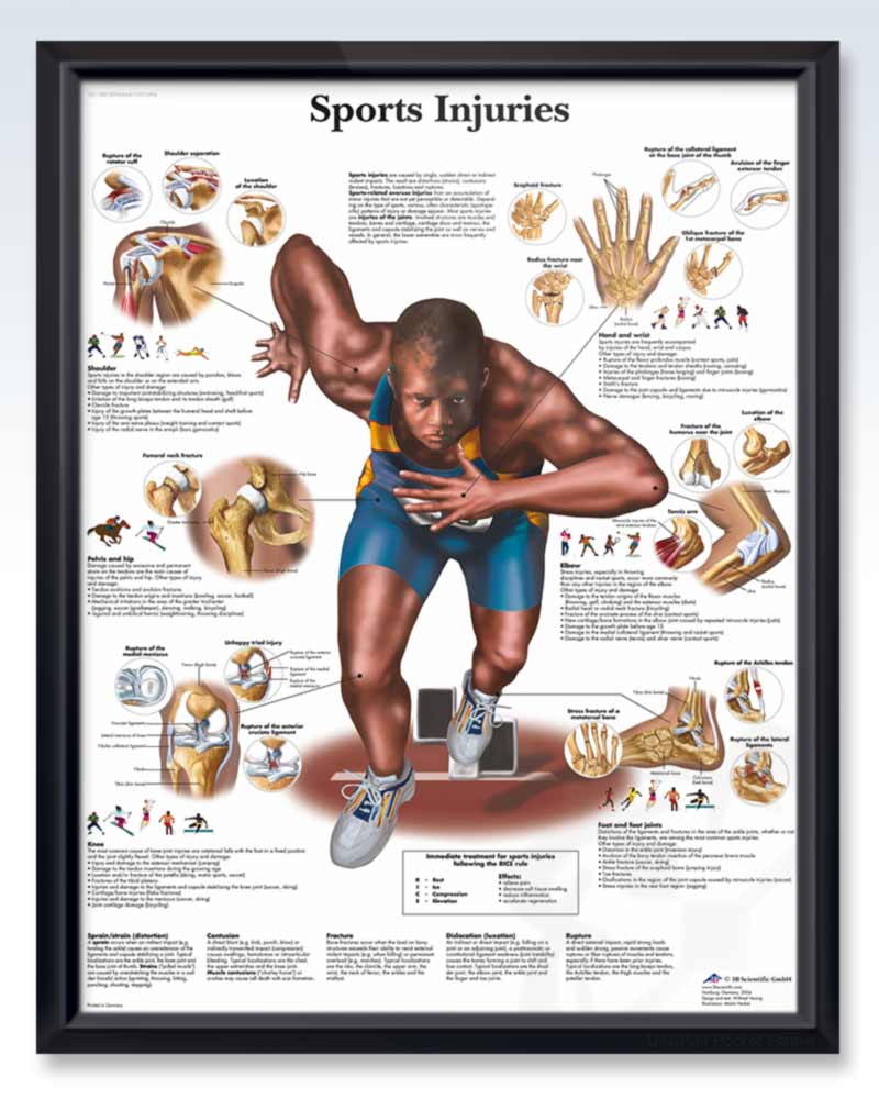 Sports Injuries Exam Room Poster | ClinicalPosters