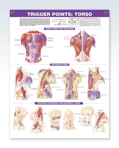 Laminated Trigger Points Set Anatomy Posters | ClinicalPosters