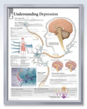 Understanding Depression Exam-Room Anatomy Poster | ClinicalPosters
