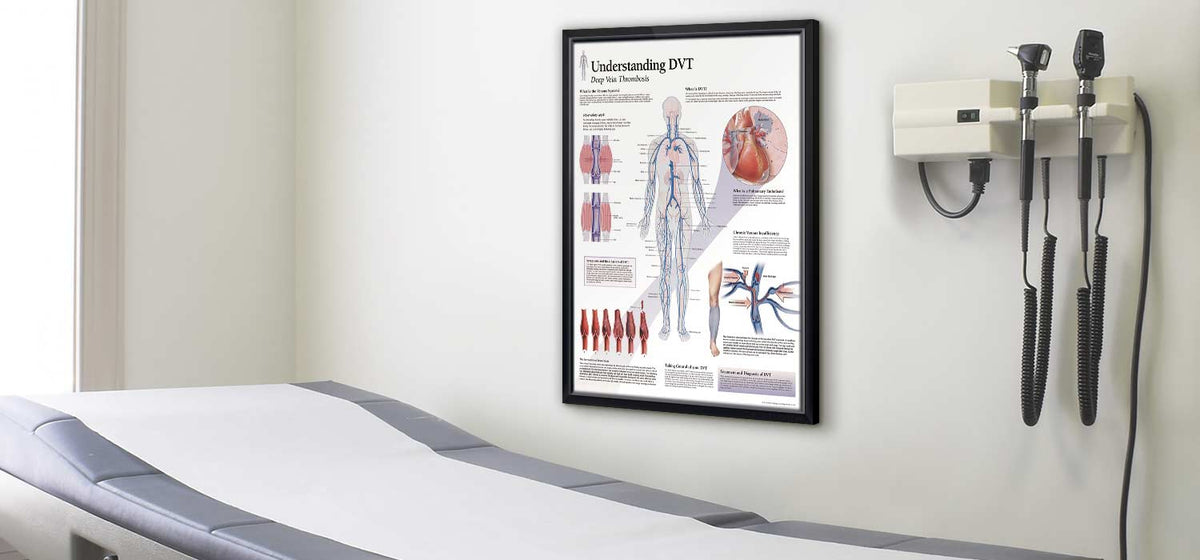 Understanding DVT Exam-Room Anatomy Poster | ClinicalPosters