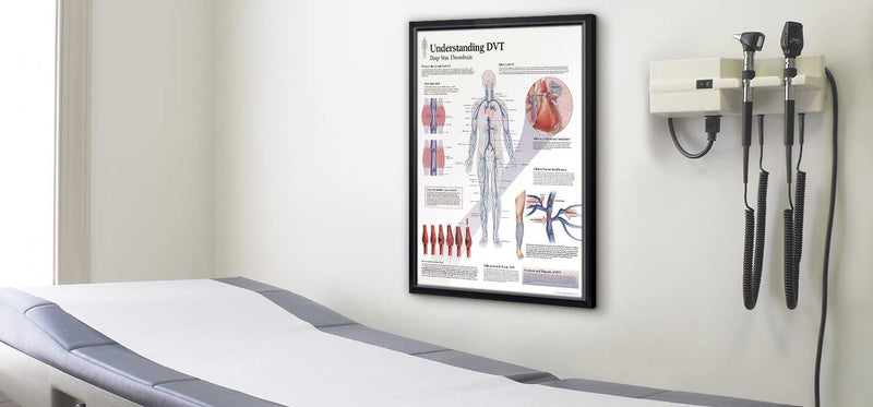 Understanding DVT Exam-Room Anatomy Poster | ClinicalPosters