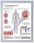 Understanding DVT Exam-Room Anatomy Poster | ClinicalPosters