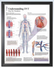 Understanding DVT Exam-Room Anatomy Poster | ClinicalPosters