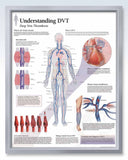 Understanding DVT Exam-Room Anatomy Poster | ClinicalPosters