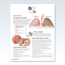 Understanding Womens Health Flip Chart – ClinicalPosters